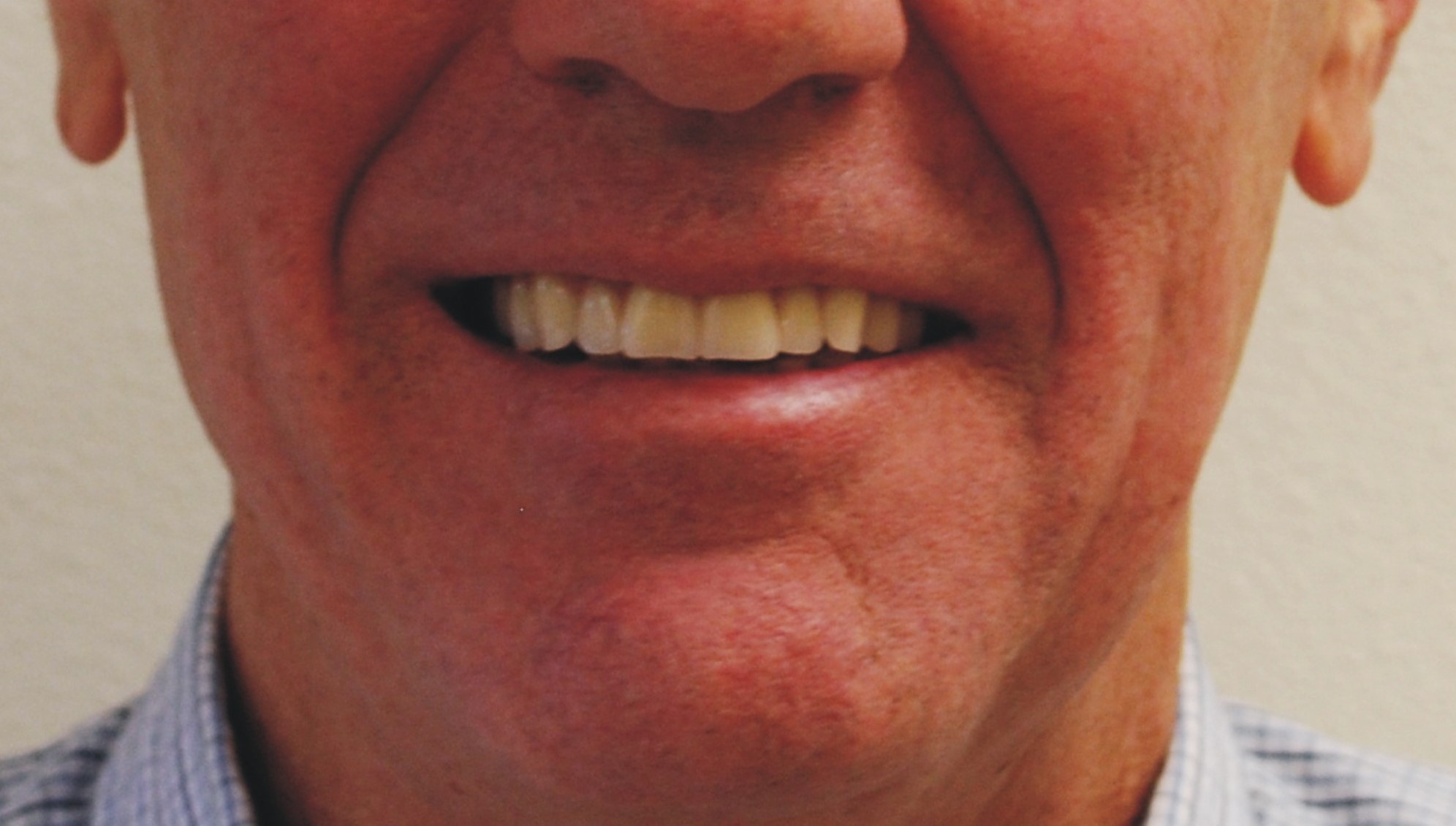 Grant Smith Denture Studio – Personalized Denture Care